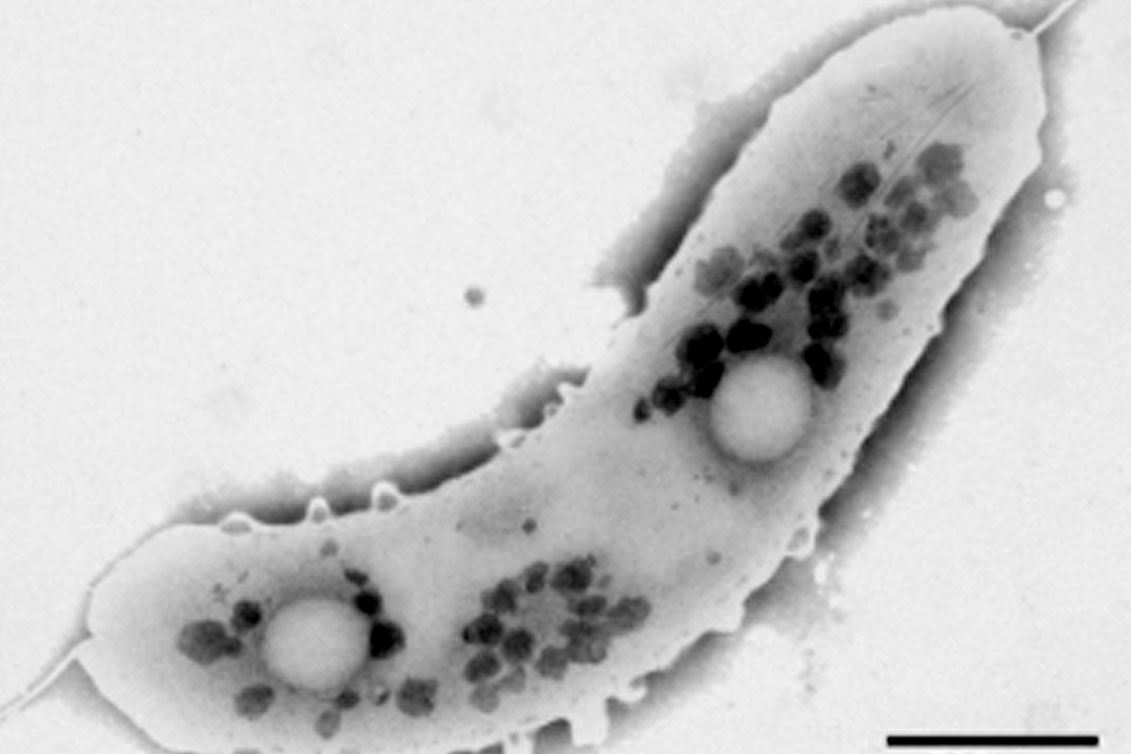 TEM Jeol 1010: operating voltage 40-100 kV, CCD camera, 1 nm resolution ...