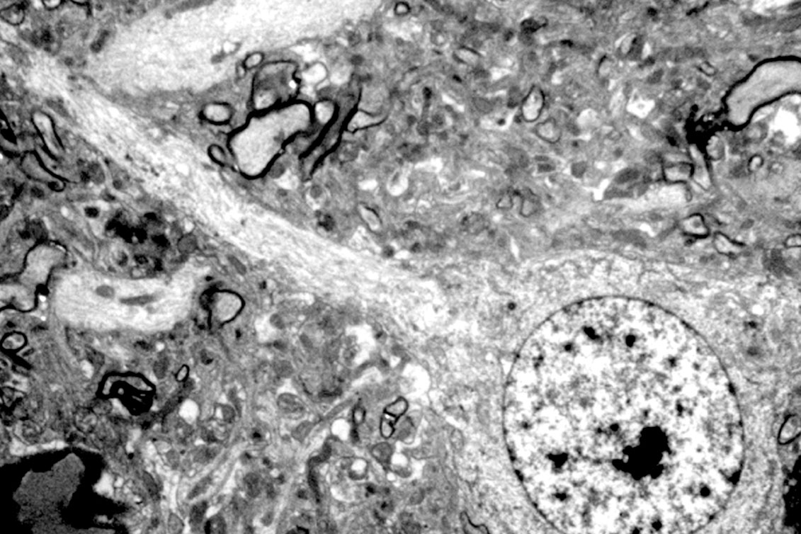 TEM Jeol 1010: operating voltage 40-100 kV, CCD camera, 1 nm resolution ...